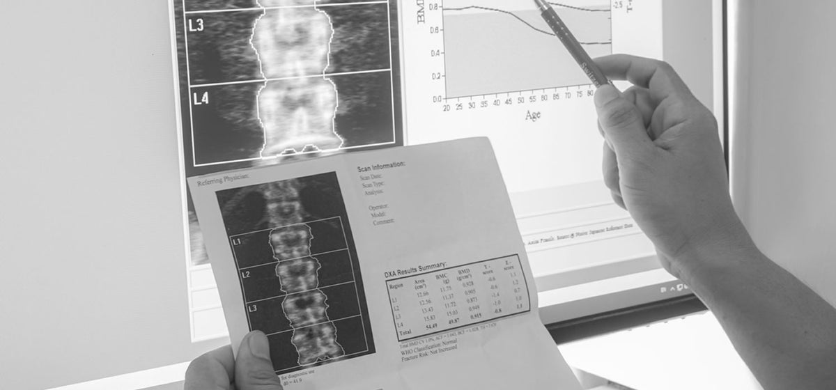 Comprehensive Bone Density and Body Composition Analysis: DEXA Scan ...